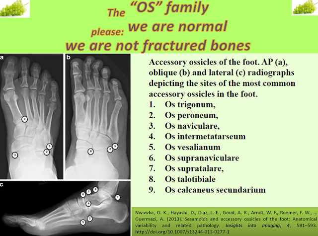 Easy Radiology: Congenital Bone diseases & malformation and normal ...
