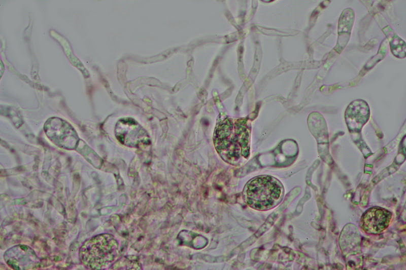 El mundo microscópico de los hongos: Sebacina incrustans (Pers. ex Fr.)Tul.