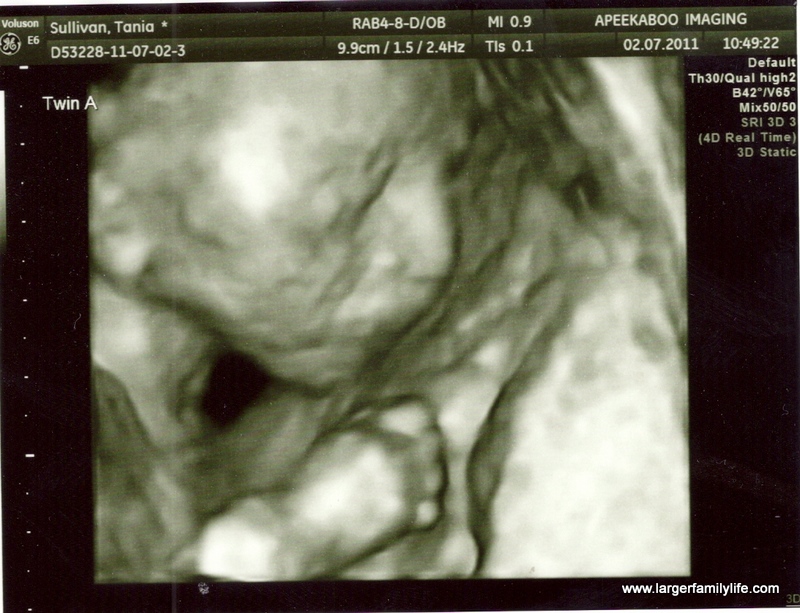 4d baby scans, anomaly scans and the miracle of life | Larger Family Life