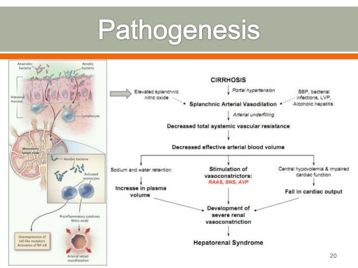 Medical Science: Hepato Renal Syndrome