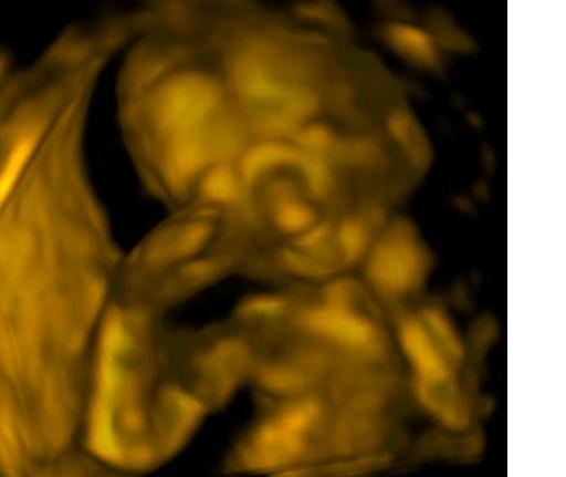 First Choice Baby Scan: 19 Weeks pregnant