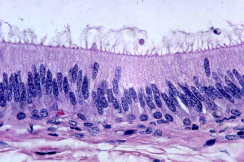 Histology Doodles: Stereocilia on simple columnar epithelia, H&E