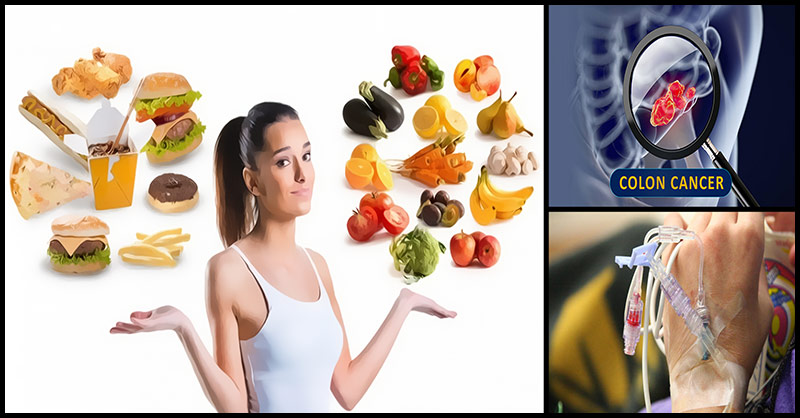 Help Ease Colon Cancer Symptoms By Eating The Right Foods | Dr Farrah MD