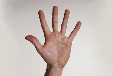 Mengatasi tangan panas - nyeritain.com