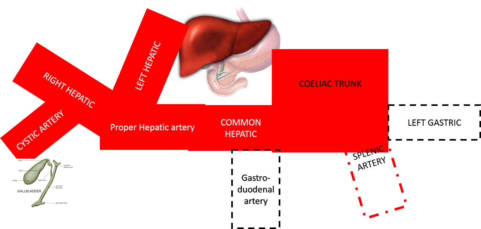 Coeliac Trunk: Step by Step