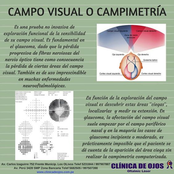 Clínica de Ojos Oftalmic Láser: CAMPO VISUAL O CAMPIMETRÍA