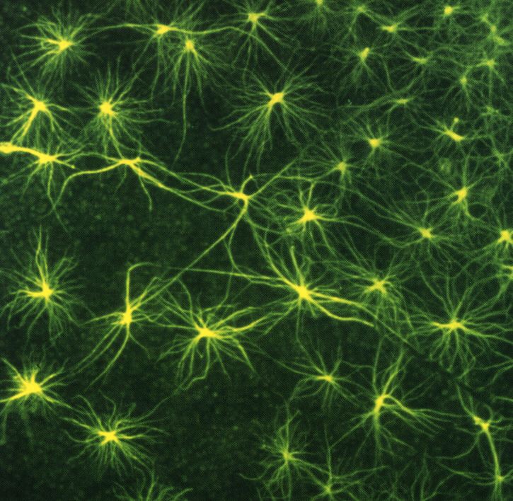BIOLOGÍA: LOS ASTROCITOS: CÉLULAS CLAVES EN EL ALZHEIMER