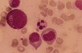 HEMATOLOGIA: PROMIELOCITO