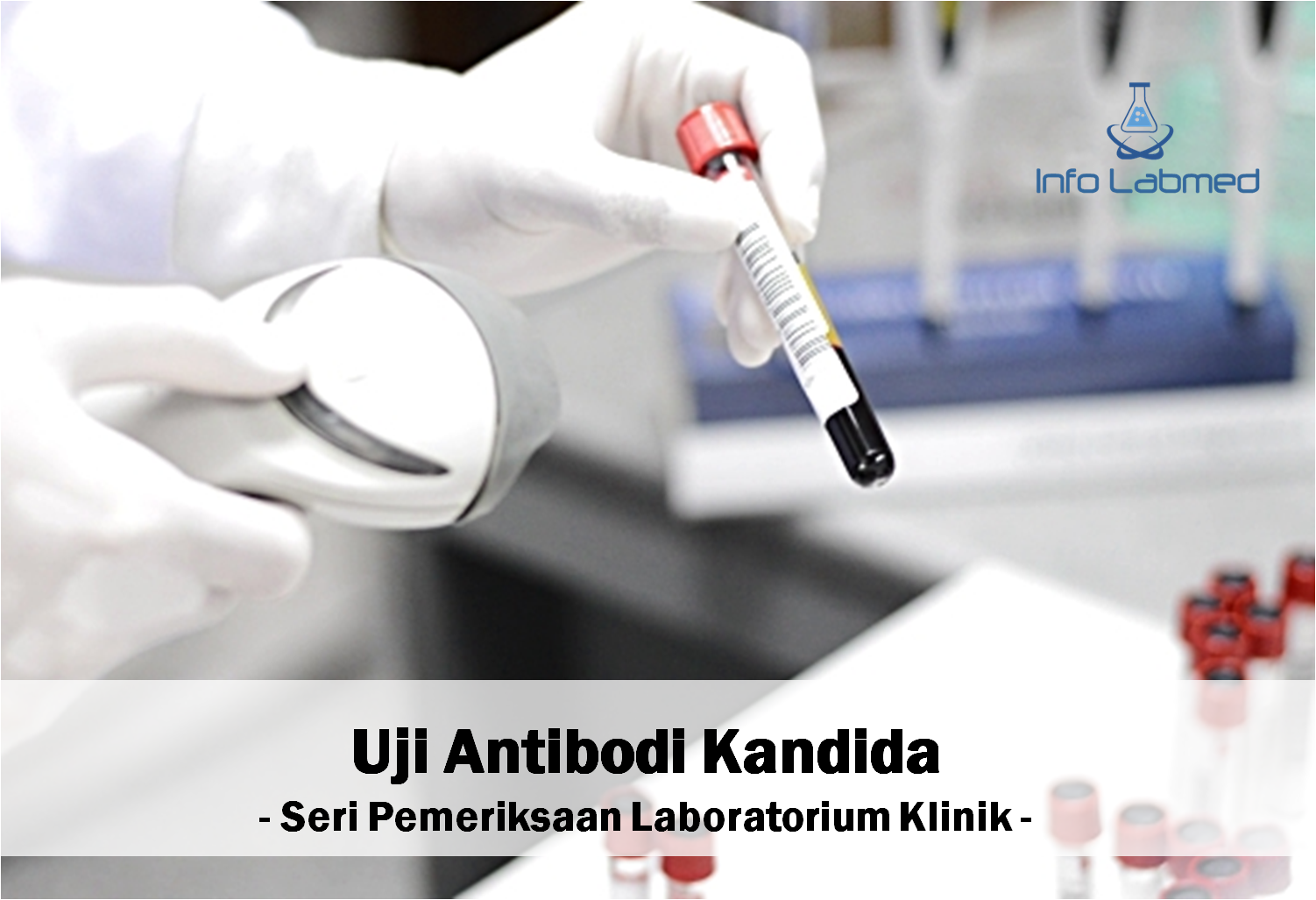 Uji Antibodi Kandida - Seri Pemeriksaan Laboratorium Klinik