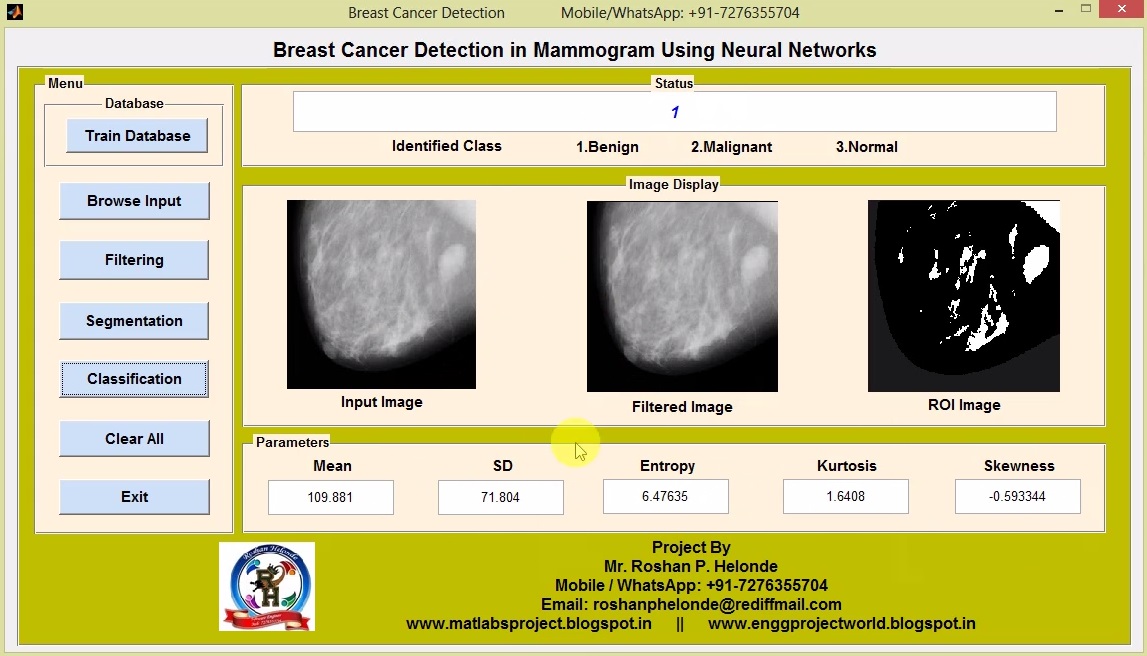 Breast Cancer Detection And Classification Using Neural Network In
