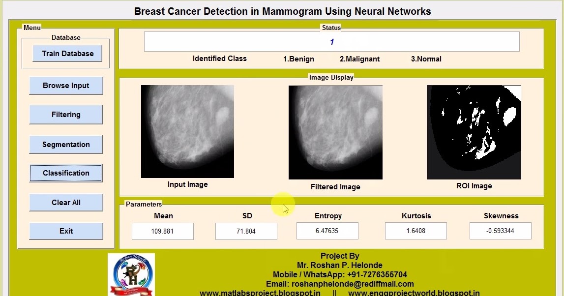 Breast Cancer Detection And Classification Using Neural Network In Mammograms Matlab Project