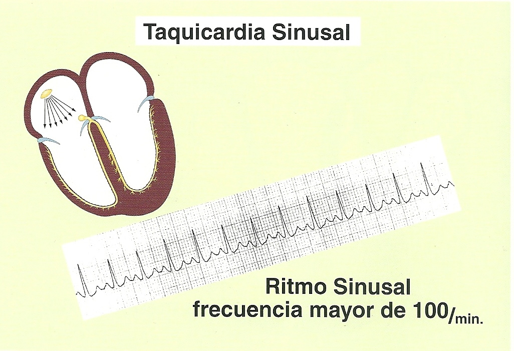 Dr. Rafael Soto - Electrocardiografía - Cardiología clínica ...