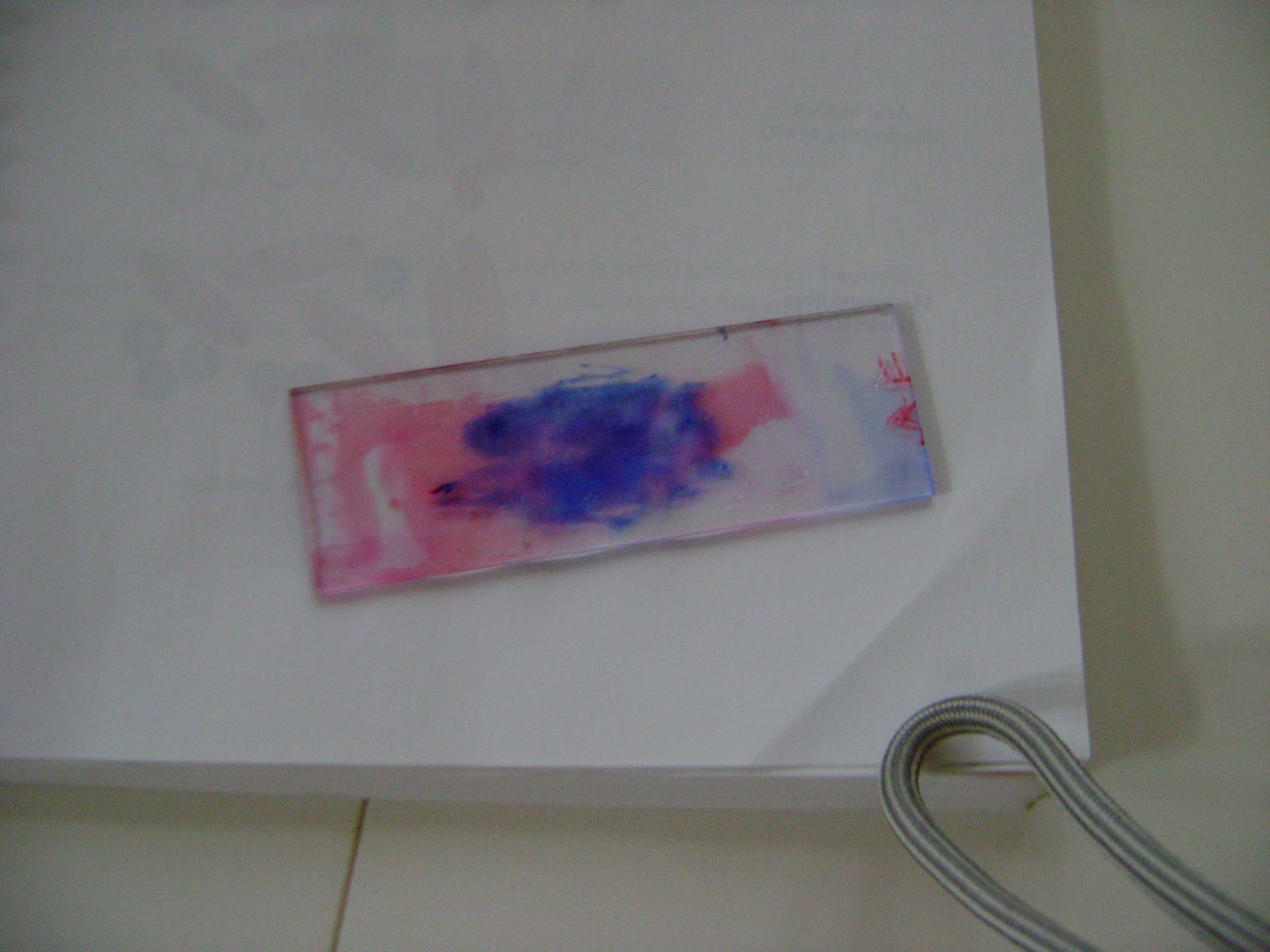 MedicALI Microbiology: Acid Fast and Endospore Staining!