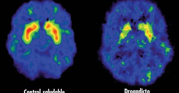 Nuestro Mundo Interesante Con Los Ojos De Un Inmigrante El Cerebro