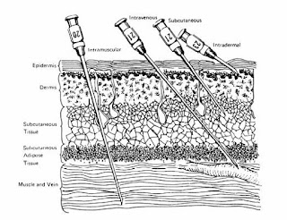 Macam Macam Injeksi « BACA SAJA