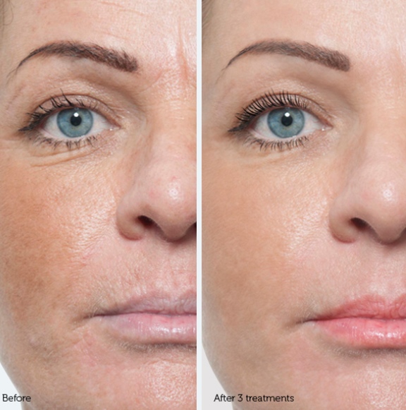 Coulda Shoulda Woulda: Rolling, rolling, rolling. Rawhide?