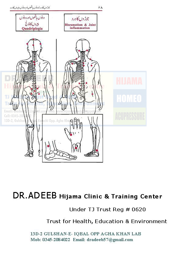 HIJAMA ( Blood Cupping ): Hijama Disease Points
