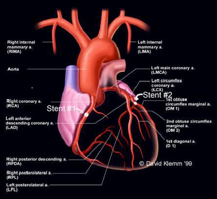 M3D1C1N4: Circulación coronaria