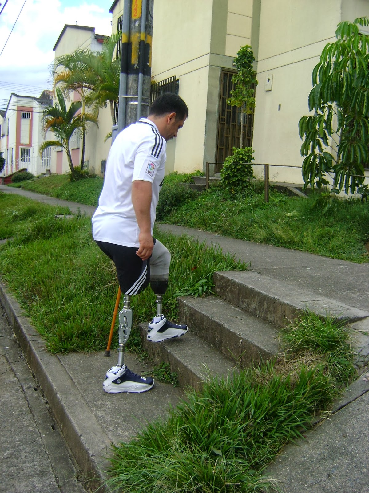 Being an Amputee is not Shame: Hernan Perrilla - Bilateral Amputee