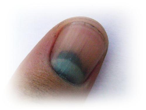 EDUCACIÓN FÍSICA E.N.P 9 : PRIMEROS AUXILIOS.