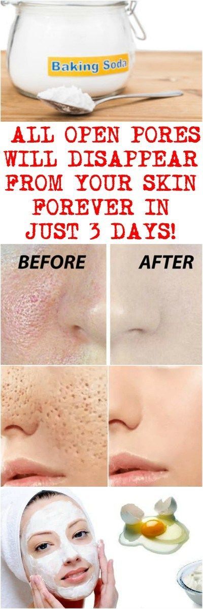 How To Get Rid Of Enlarged Pores Naturally