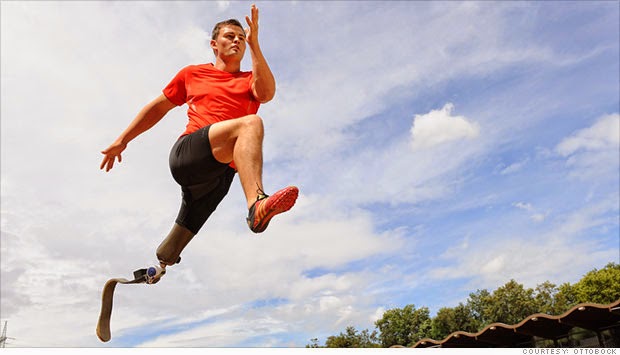 Riyesh Menon: Advanced prosthetic limbs: Leveling the playing field for ...