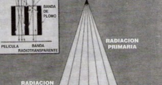 UN ESPACIO PARA LA RADIOLOGÍA.: TIPOS DE RADIACION.
