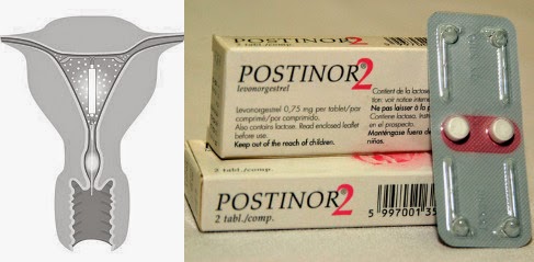 Must Read For Ladies!!! The Shocking Side Effect Of Postinor 2 (Drug ...