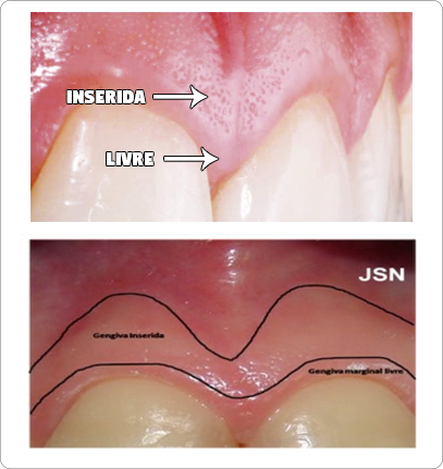 Aula de Periodontia - Anatomia, Histologia e Fisiologia do Periodonto ...