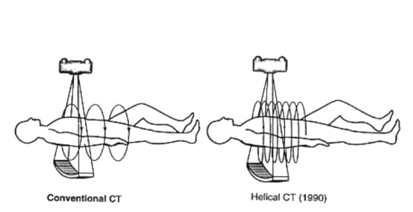 บันทึกของลูกช้างรังสี: หลักการทำงานของ Spiral CT.