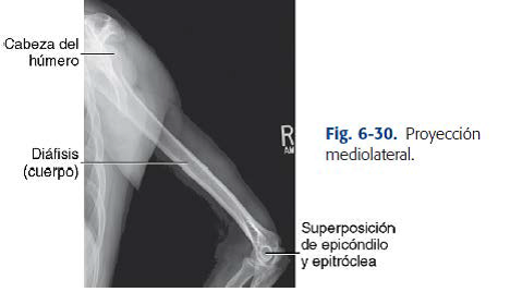 PRODUCCION Y TRATAMIENTO DE IMAGENES DIAGNOSTICAS: CAPITULO HUMERO Y ...