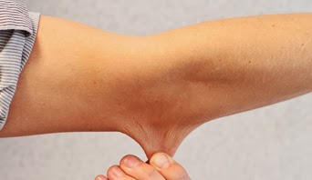 10 Cara Alami Menghilangkan Selulit | BlogDokter