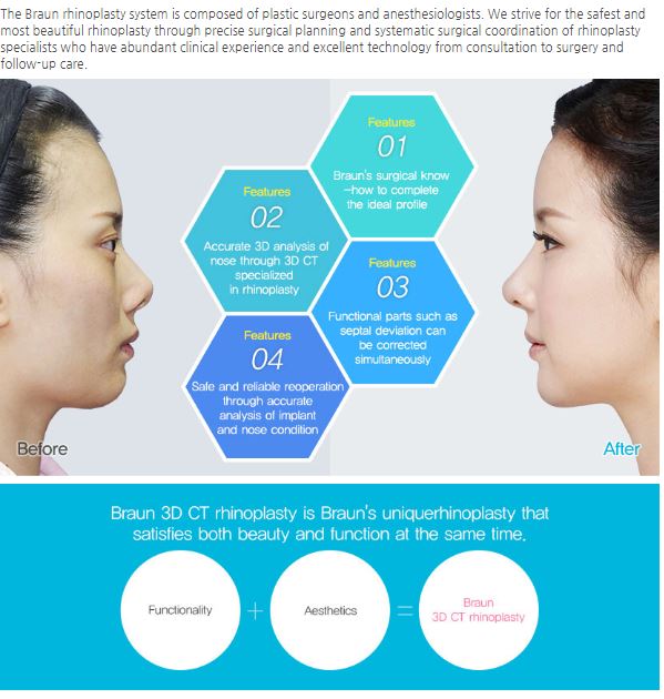 3DCT Rhinoplasty for the first time in Korea! Braun Plastic Surgery