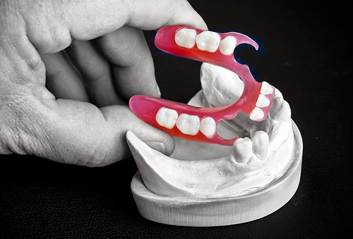 CERAM FES - laboratoire de prothese dentaire