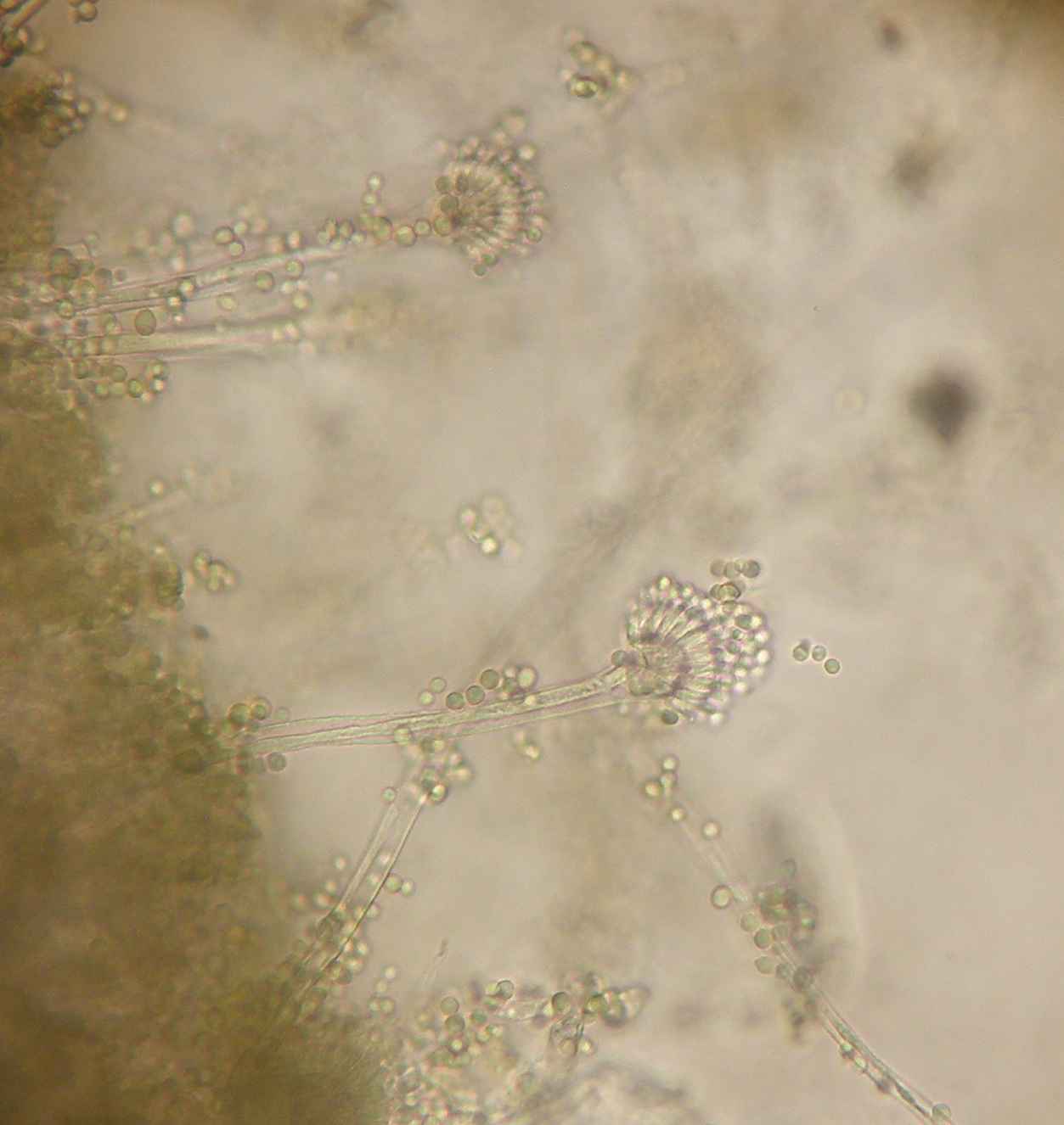 ATLAS MICOLOGIA: ASPERGILLUS FLAVUS