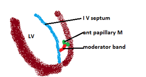 easyhumanatomy: Moderator band / septomarginal trabeculum