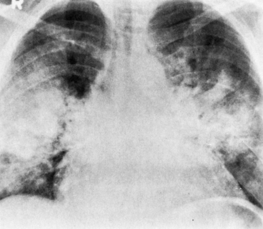 EL RINCÓN DE LA MEDICINA INTERNA. juanpedromacaluso@yahoo.com.ar ...