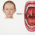 Pathway Tonsilitis, Gambar dan Penjelasannya | Penyakit Tonsilitis