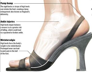 Le massage en images - A massagem em imagens: talons hauts ...