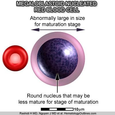 VETERINARY HEMATOLOGY DEXTERVET: megaloblast