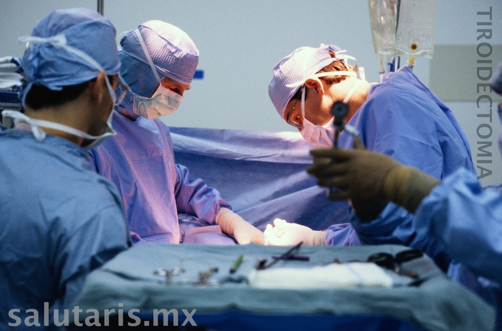 SALUTARIS MEDICAL CENTER: Hemitiroidectomia y Tiroidectomía total