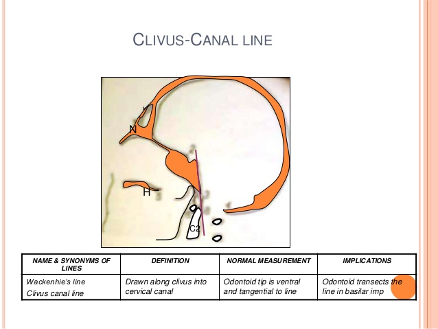 Med On The Go: C-Spinal Injury and Diagnosis