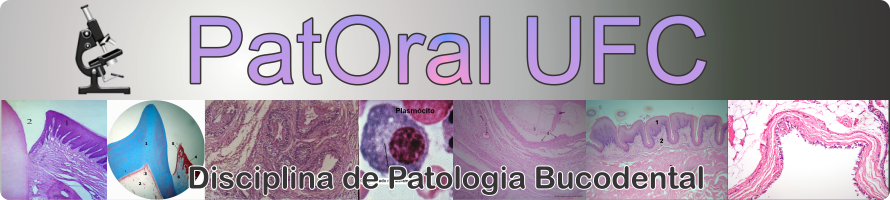 PatOral UFC: Imagens Histopatológicas