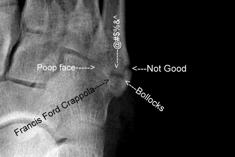 Good Foot, Bad Foot, Sad Foot, Crap Foot