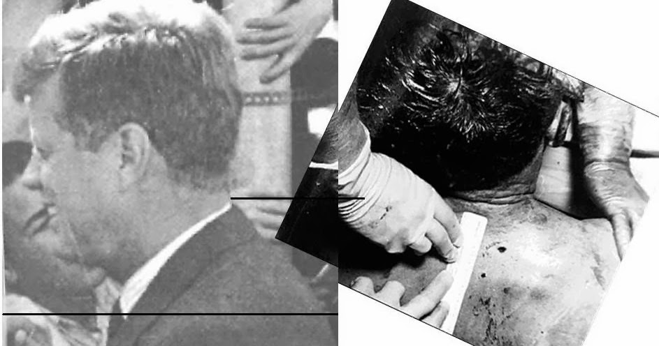 DVP's JFK ARCHIVES: JFK ASSASSINATION ARGUMENTS (PART 612)