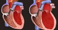 Encyclopedia of Medicine: Heart muscle disease