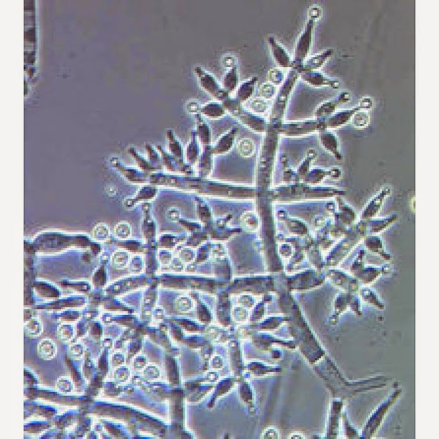 FITOSOFIA: TRICHODERMA