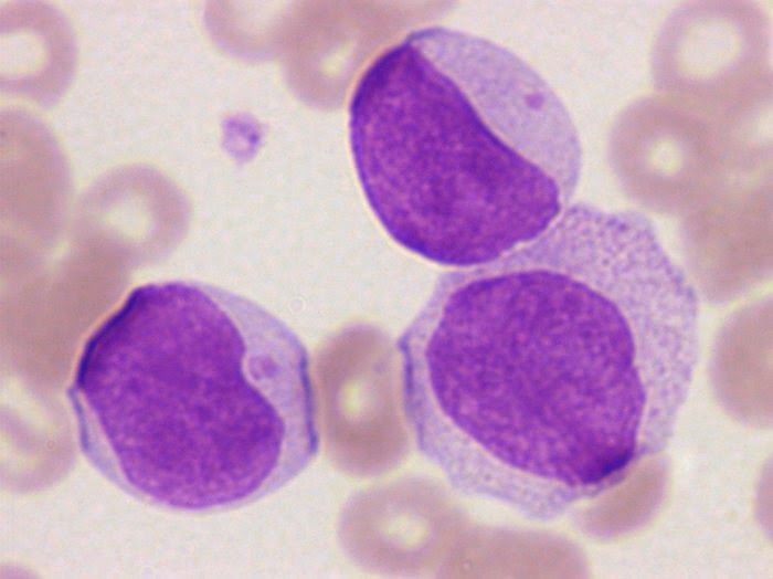 Fichero de Hematología: Promonocito