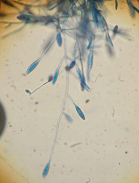 ATLAS MICOLOGIA: MICROSPORUM GYPSEUM