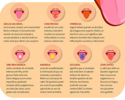 Blog Professor José Costa: O que a língua diz sobre sua saúde